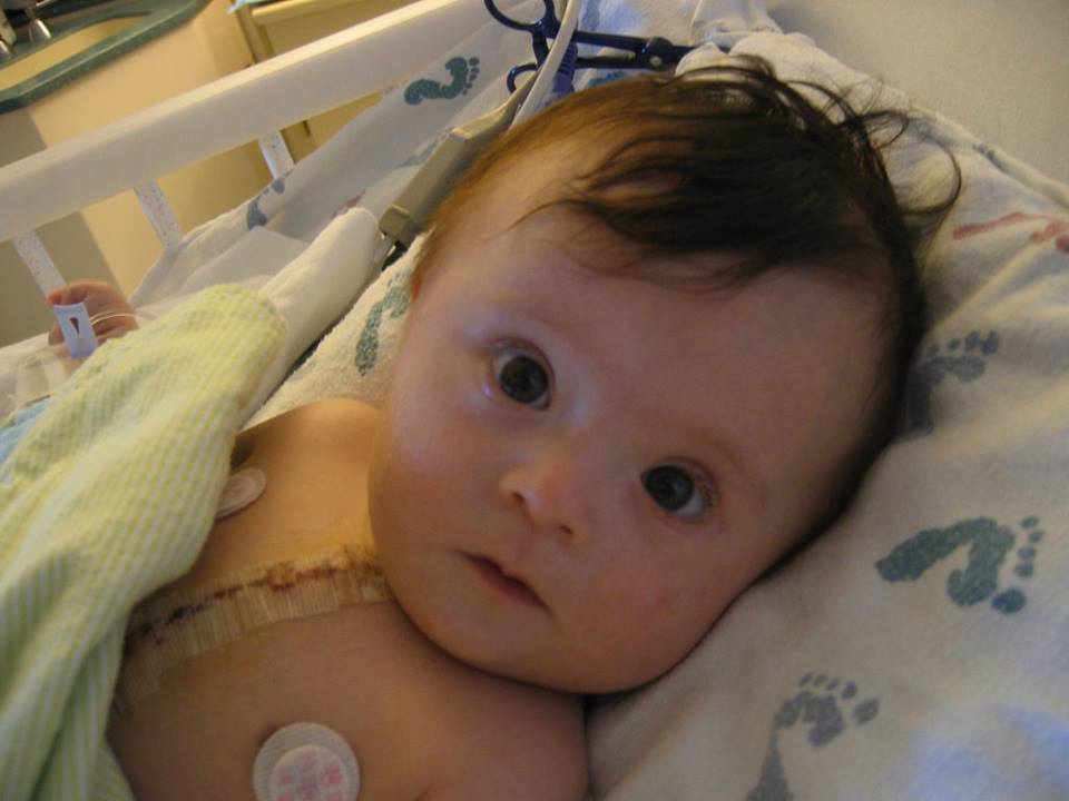 A Hole In The Heart Ventricular Septal Defects GetDoc