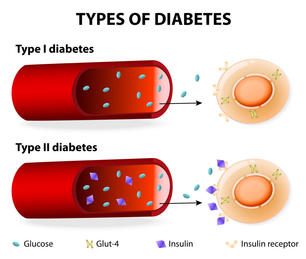 5 Types Of Diabetes | GetDoc Says