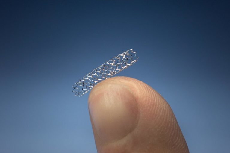 Heart Stent - Here's All You Need to Know | GetDocSays
